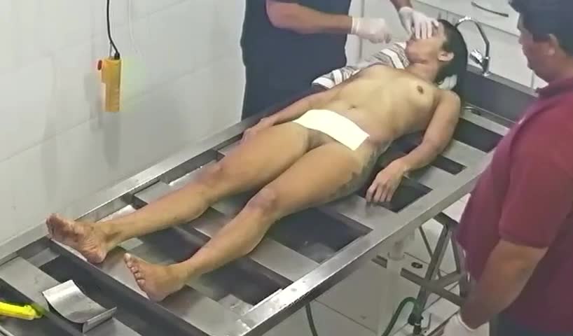 Xvidio Dead Girl Morgue Documenting Reality Frontline Post Mortem